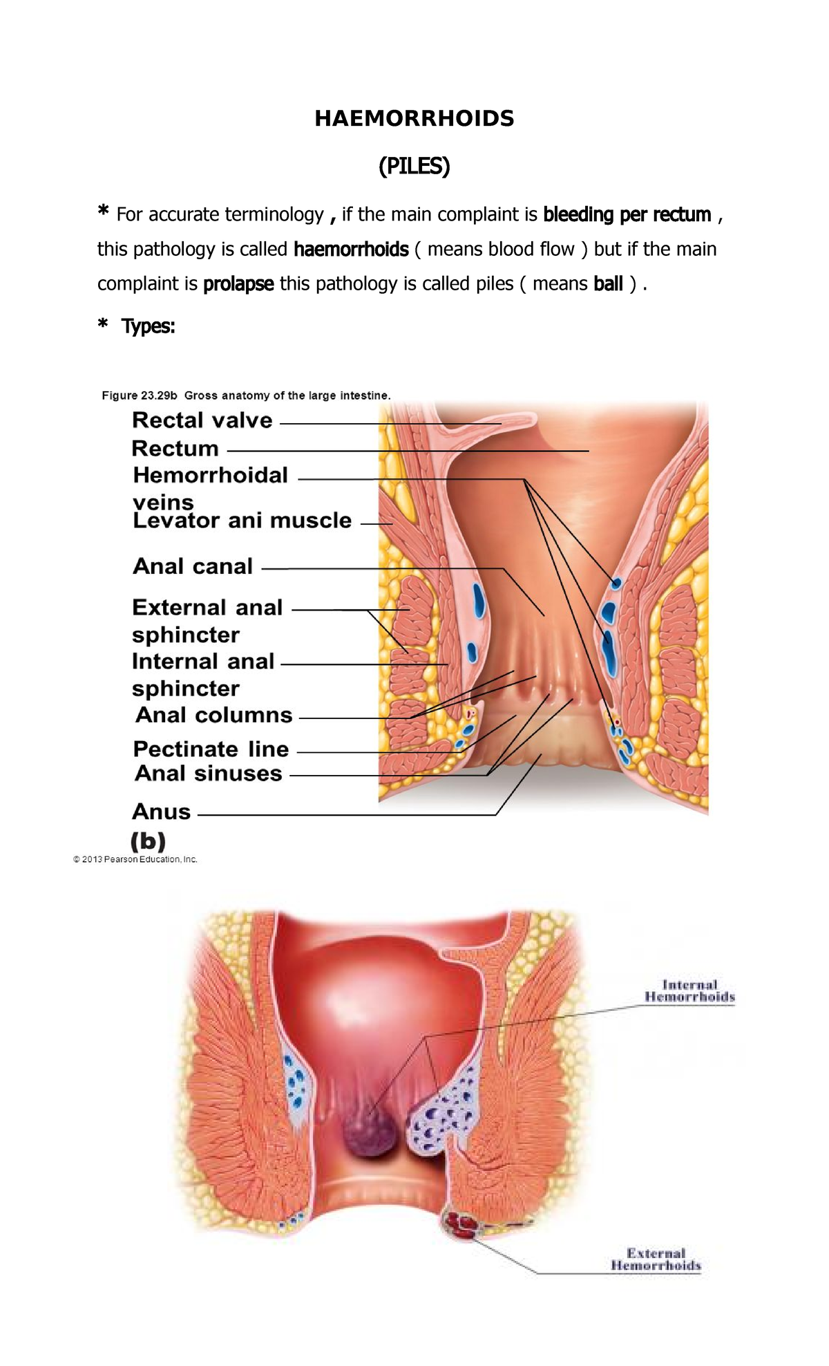 Haemorrhoids - Types: Internal piles 2. External piles Plexus affected Internal haemoirhoidal ...