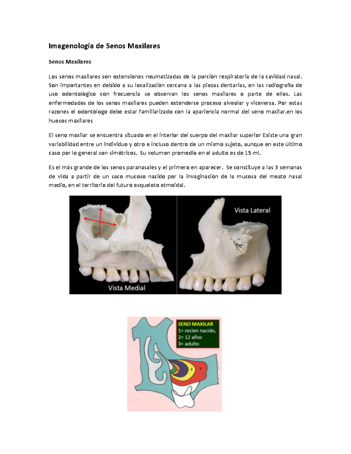 23. Imagenología de Senos Maxilares-converted - Imagenología de Senos Maxilares Senos Maxilares ...