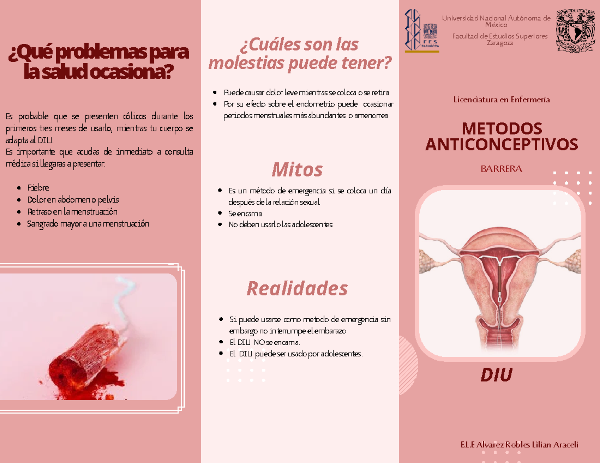 Folleto DIU - Metodo anticonceptivo - BARRERA ####### METODOS ...
