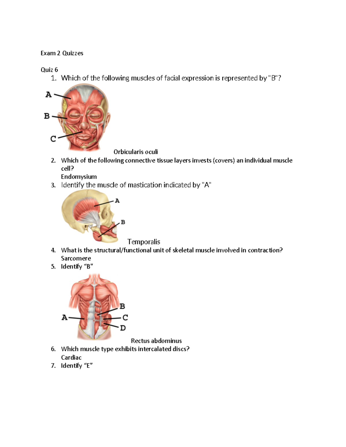 Exam 2 Quizzes - Exam 2 Quizzes Quiz 6 1. Which of the following ...