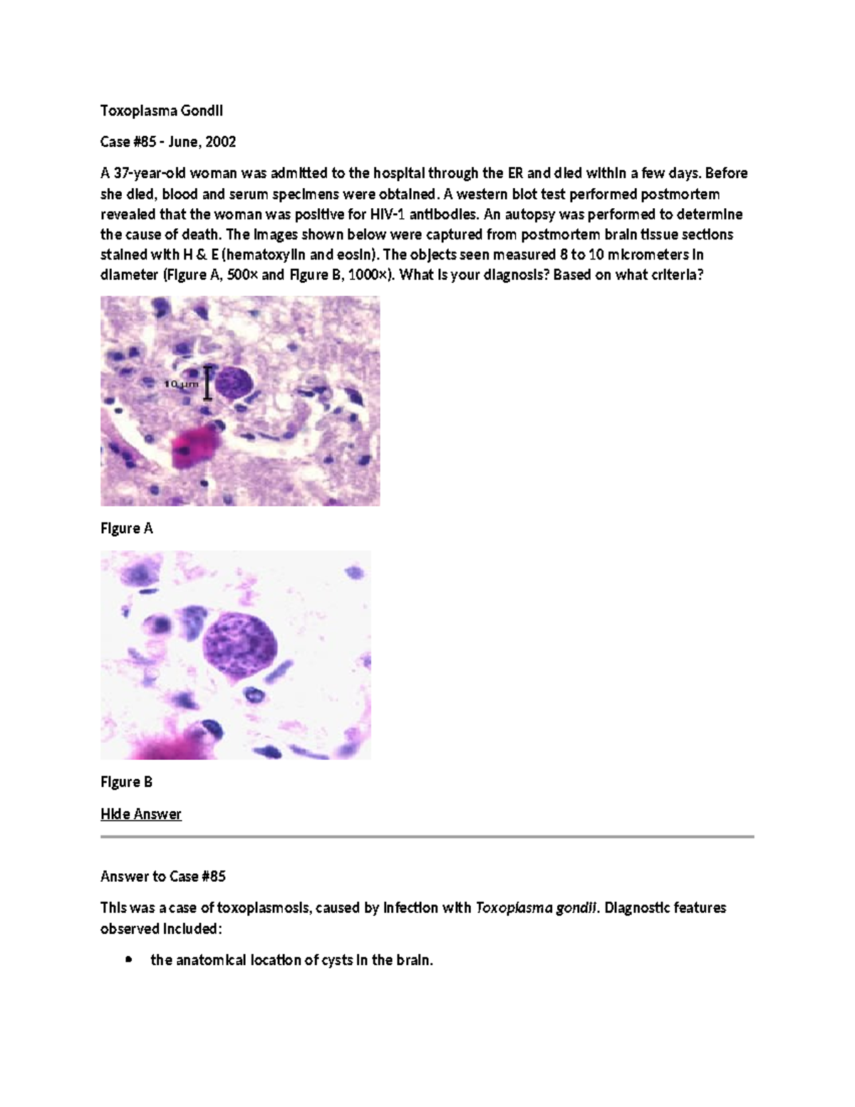 Case Studies Semis - god - Toxoplasma Gondii Case #85 - June, 2002 A 37 ...