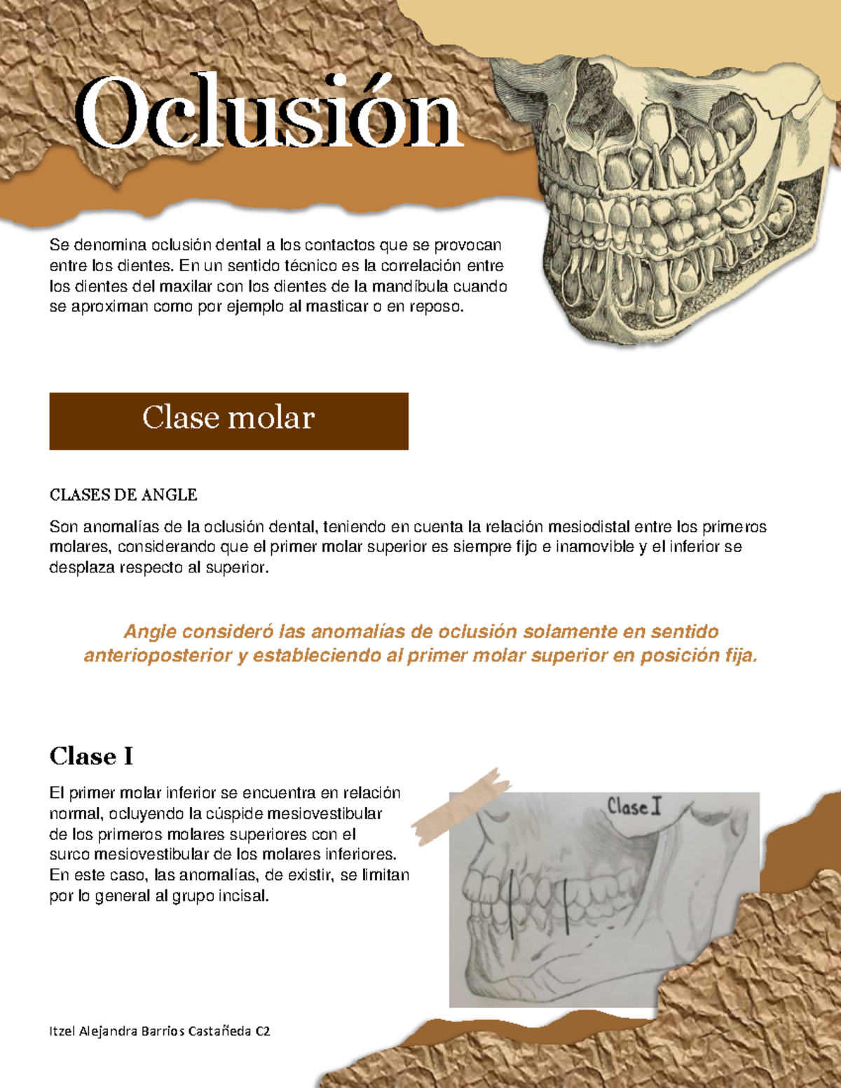 Clases dentarias molares y caninas - Se denomina oclusión dental a los ...