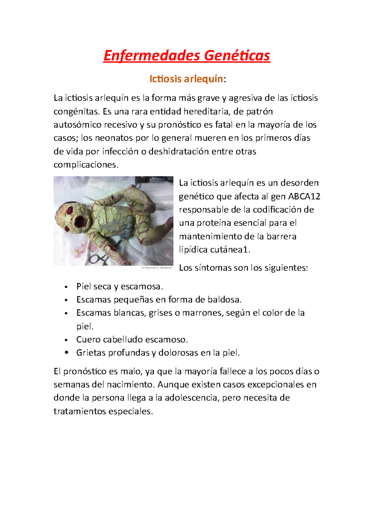 Enfermedades genetica - Enfermedades Genéticas Ictiosis arlequín: La ...