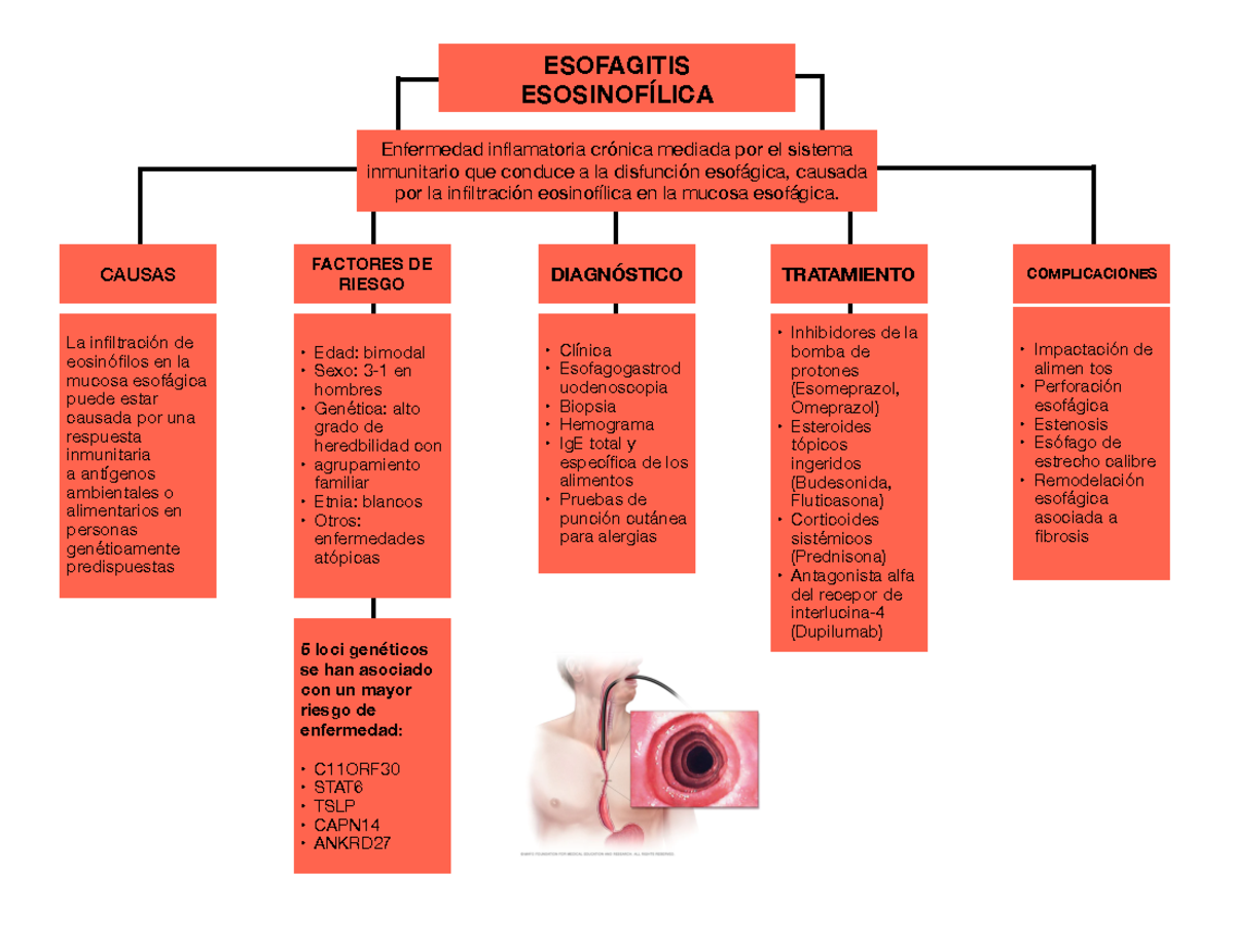 Eosofagitis EsosinofíLICA - ESOFAGITIS ESOSINOFÍLICA Enfermedad ...