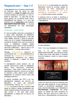 Aula 6 - Técnicas de moldagem em PPRs - Procedimentos de moldagem em ...