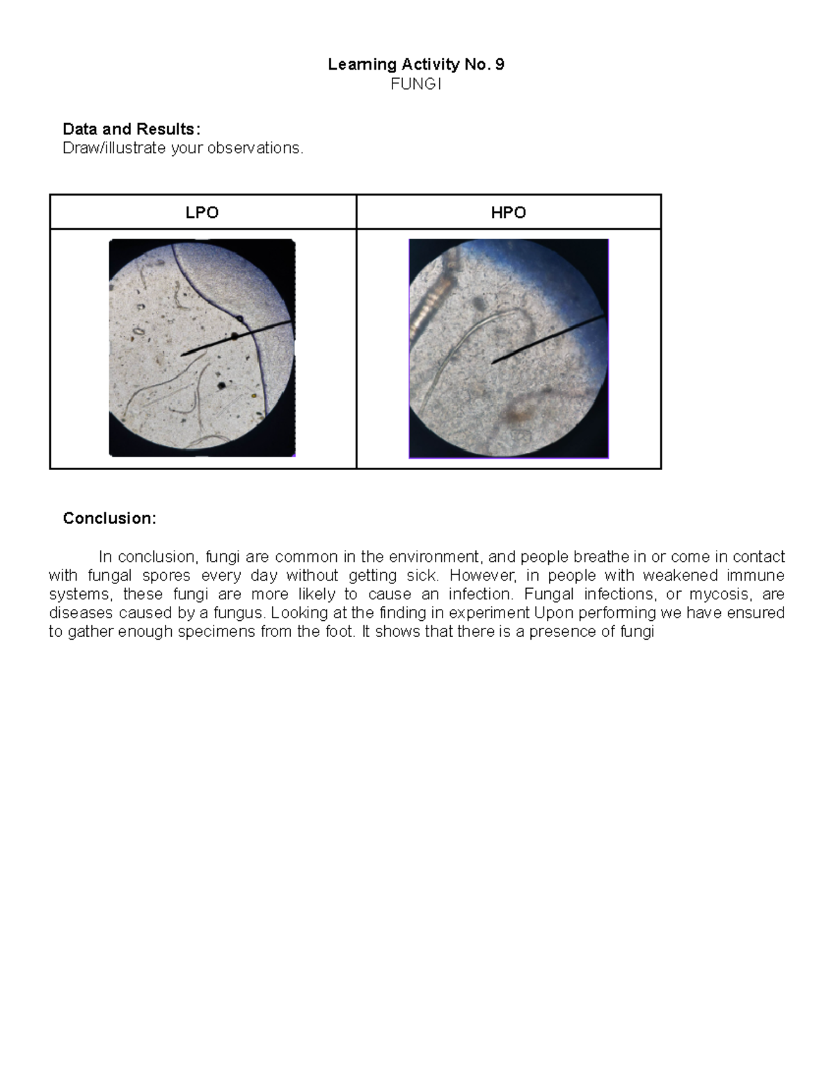 Learning Activity No.9 Fungi - Learning Activity No. 9 FUNGI Data and ...