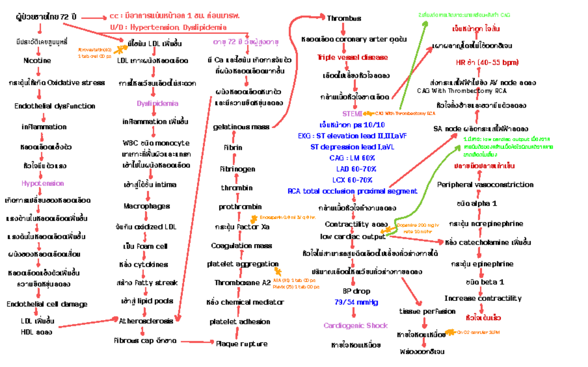 523 Stemi - Map - ####### ผู ป วยชายไทย 72 ป cc : มีอาการแน นหน าอก 1 ชม. ก อนมารพ. ####### U/D ...