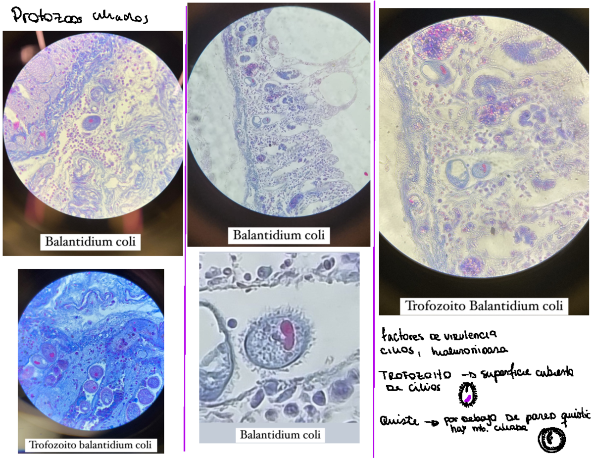 Protozoos - alabe ⑳ Trofozoito Balantidum Col-a-forma Dualada -Tiene un ...