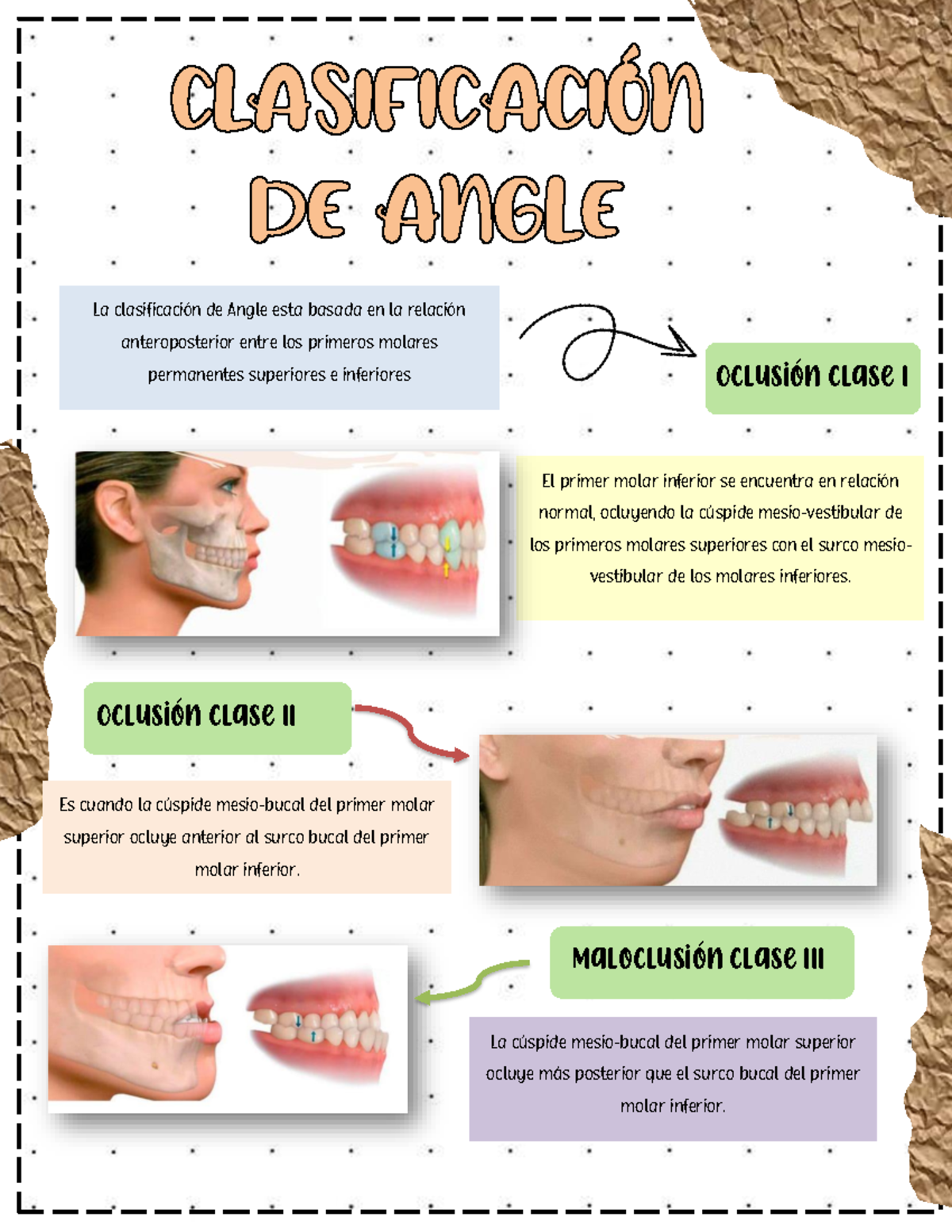 Clasificación de Angle - Oclusión clase I La clasificación de Angle ...