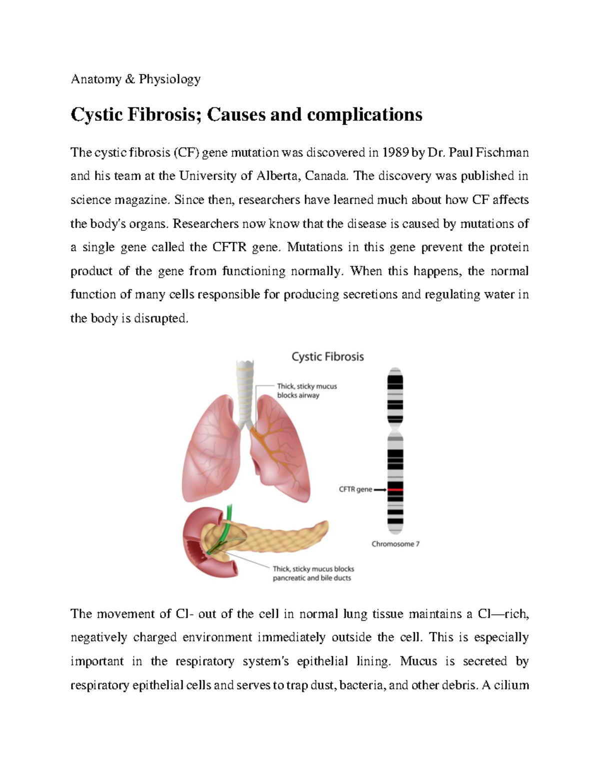 Cystic Fibrosis; Causes and complications - Anatomy & Physiology Cystic ...