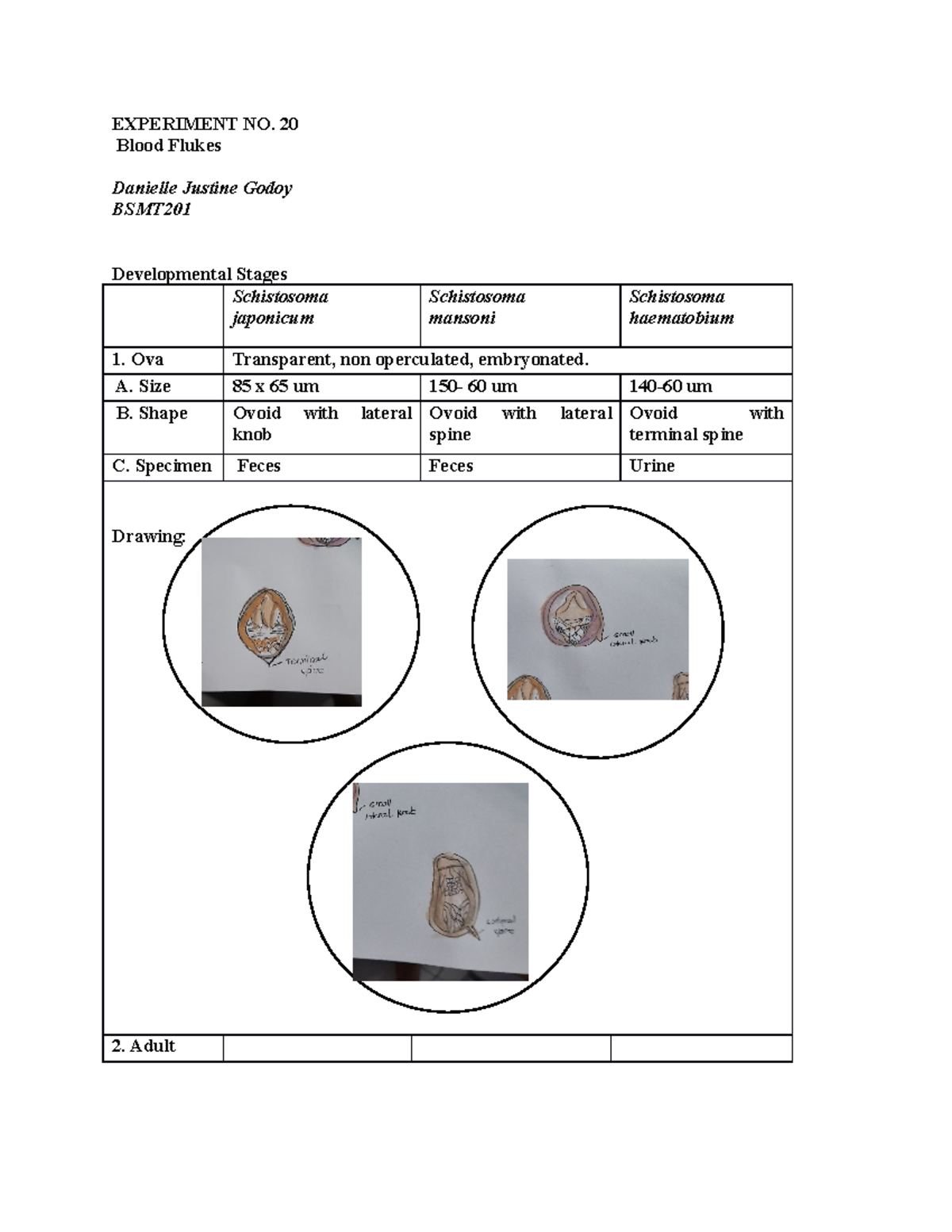 Schistosomes AND Paragonimus - EXPERIMENT NO. 20 Blood Flukes Danielle Justine Godoy BSMT - Studocu