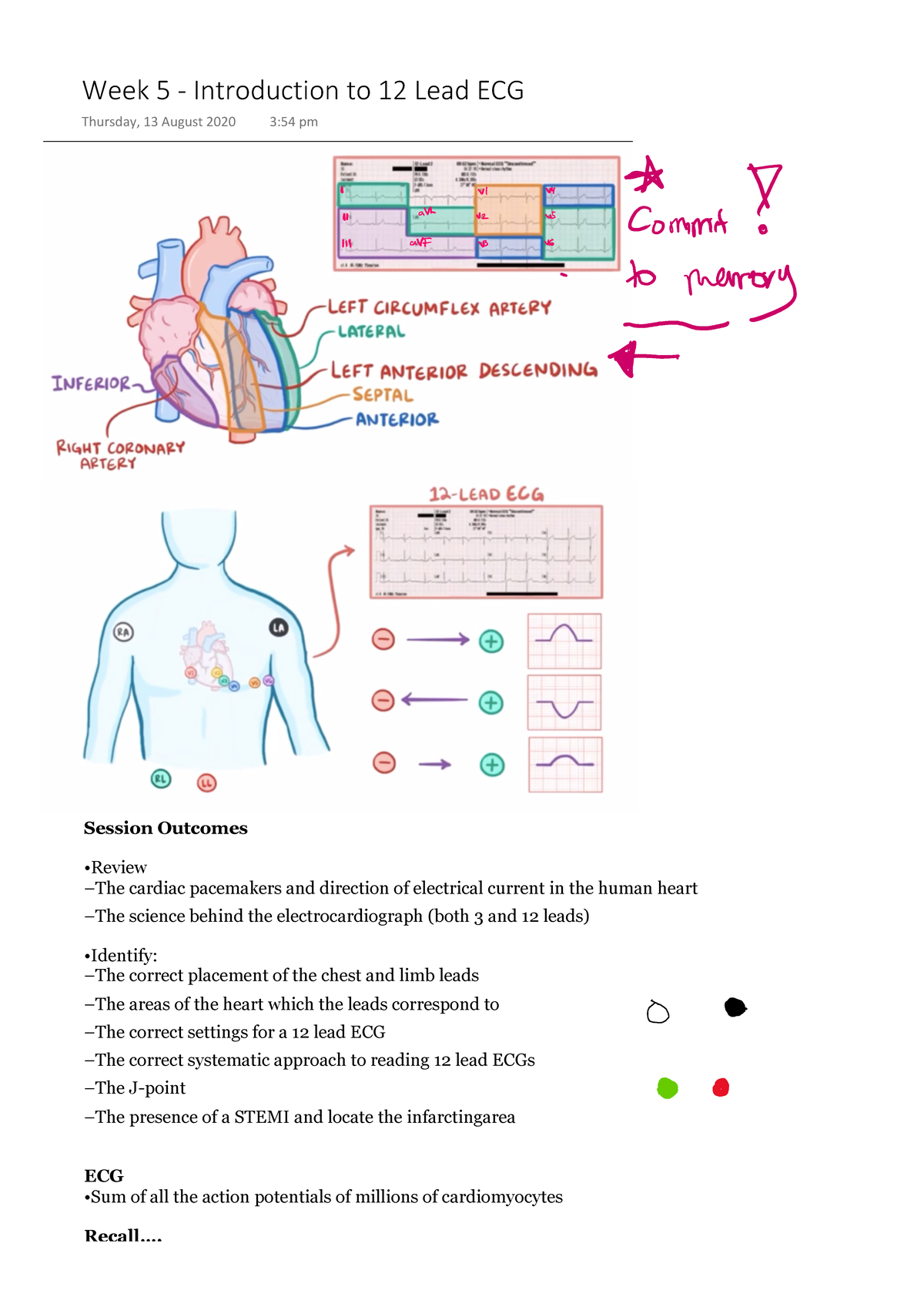 335 Week 5 - Introduction to 12 Lead ECG - Warning: TT: undefined ...
