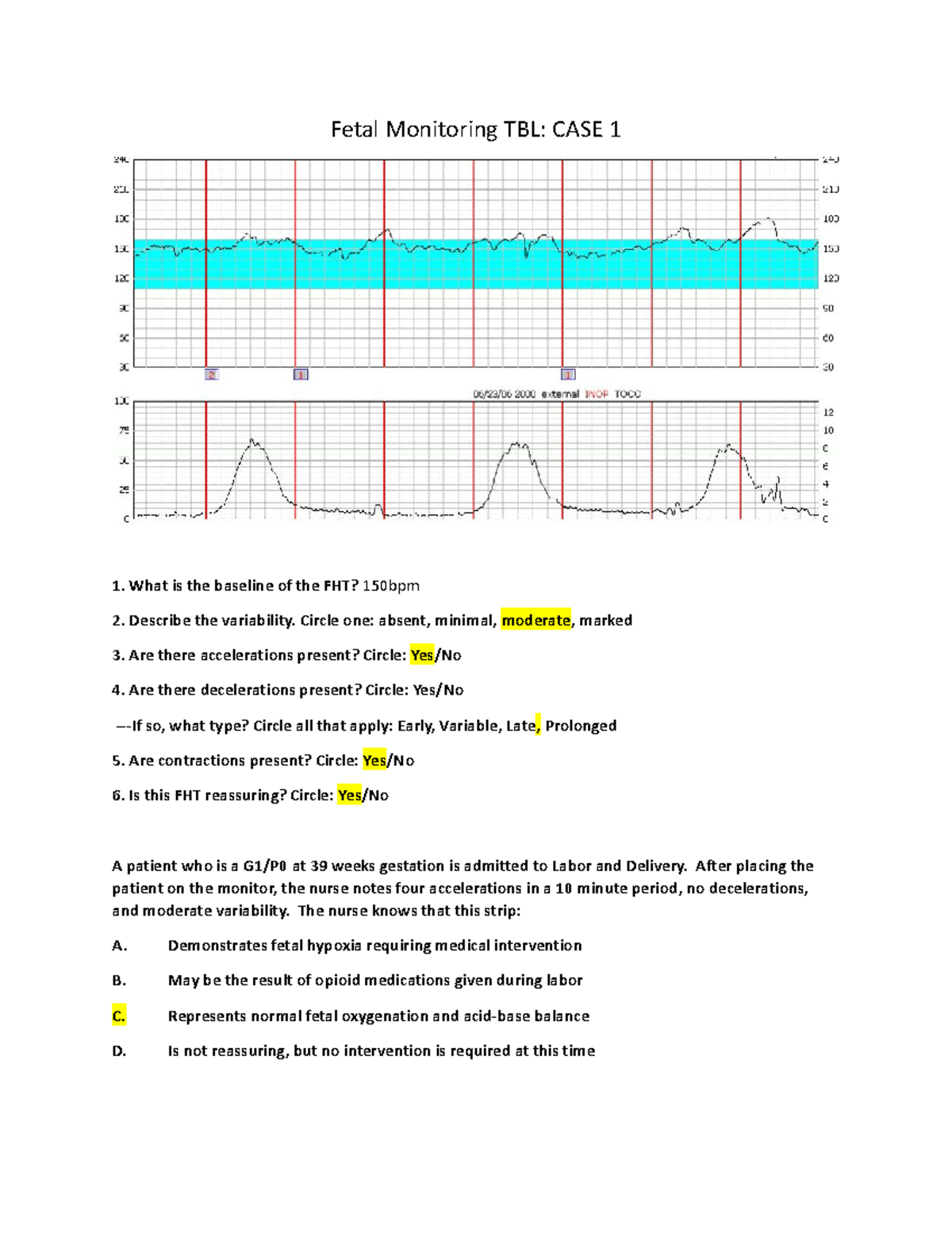 Fetal Monitoring Practice Case - What is the baseline of the FHT ...