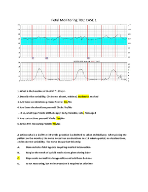 Fetal heart rate monitoring - Interpretation of strips Continuous ...