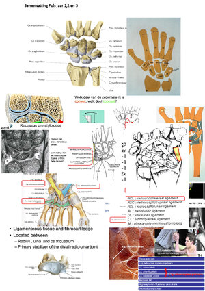 Mobiliteitsaandoeningen - Mobiliteitsaandoeningen Luxatie: Ontwrichting ...