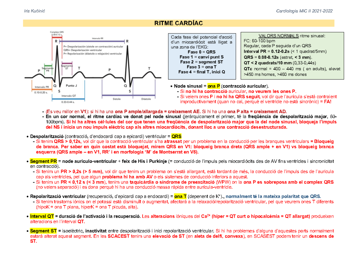 Aritmies - Sumari d'arrítmies - RITME CARDÍAC Node sinusal = ona P ...