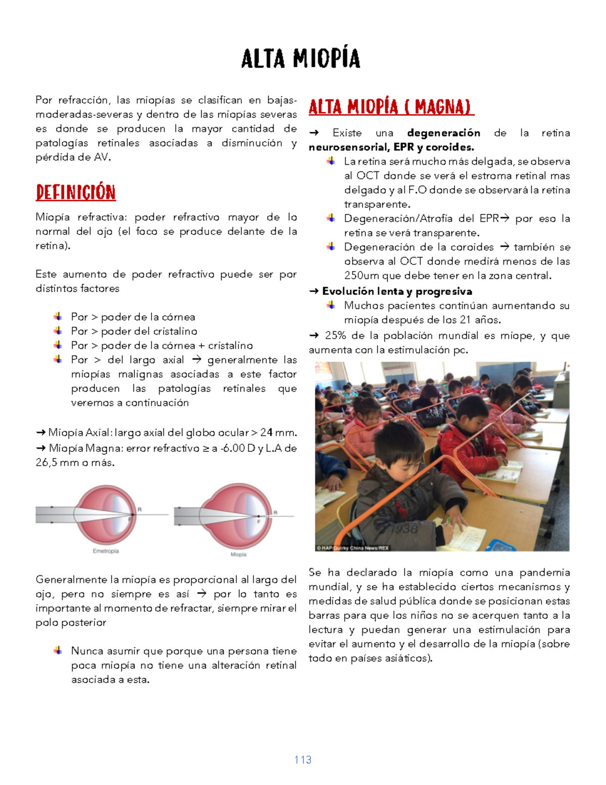 13. Miopía Alta - Por refracción, las miopías se clasifican en bajas ...