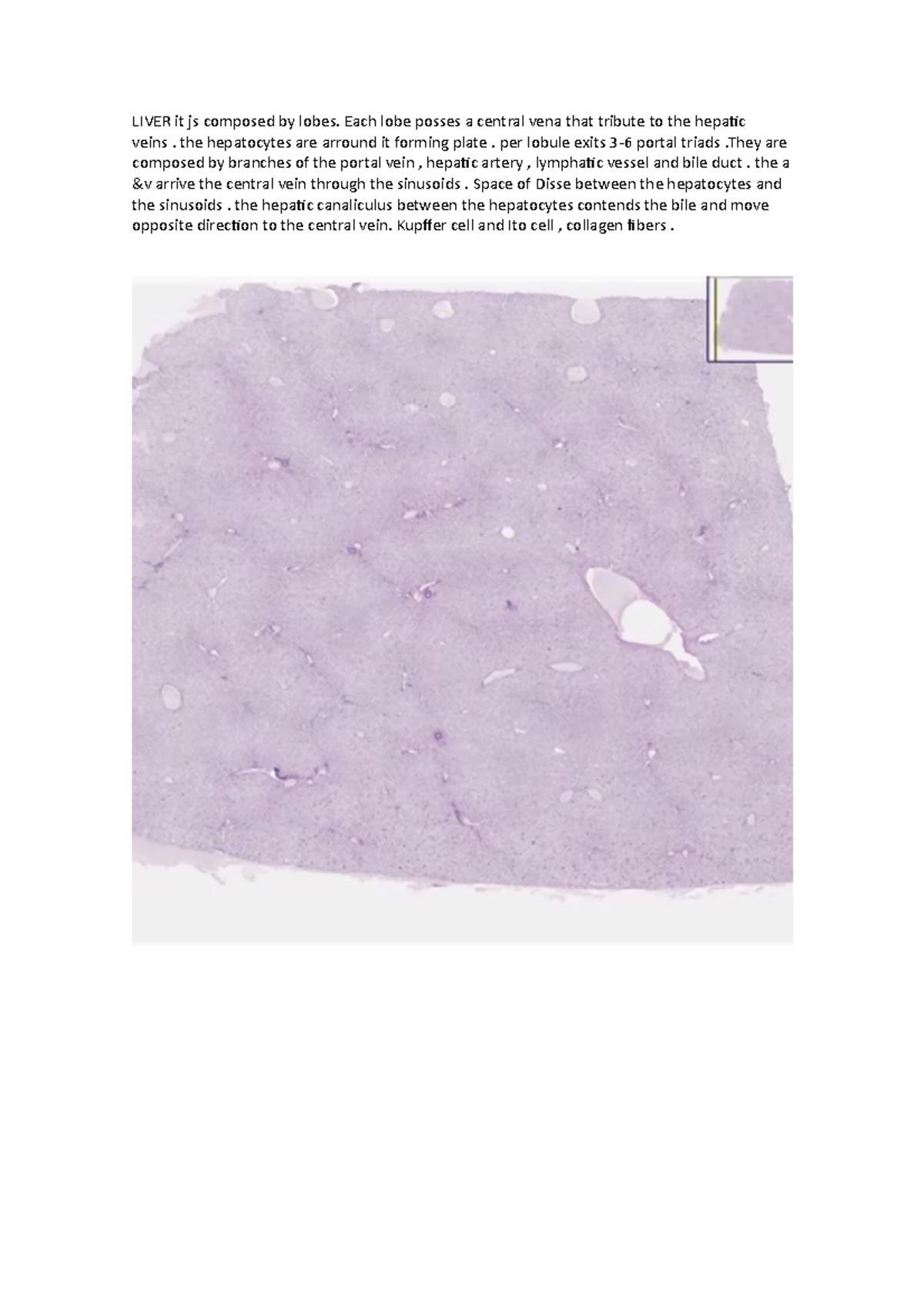 Liver - Lecture notes 1 - LIVER it js composed by lobes. Each lobe ...