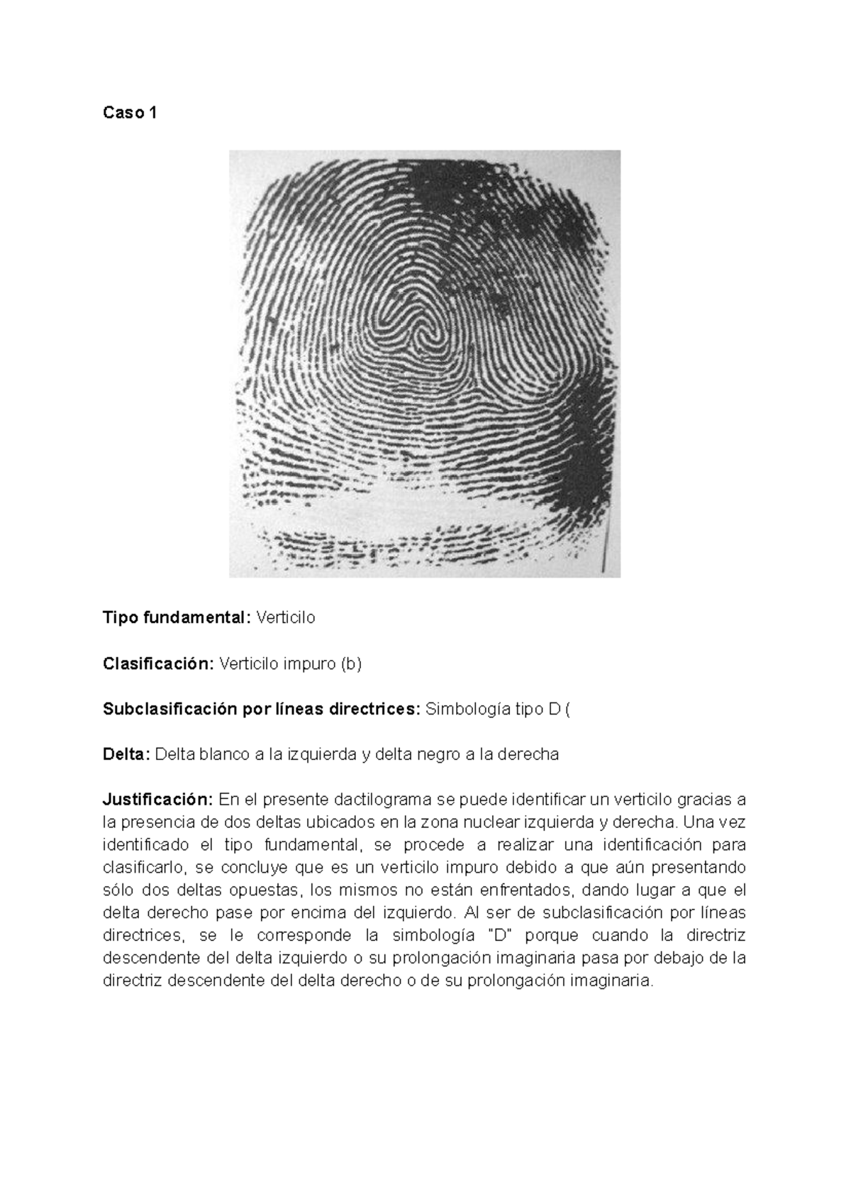 Dactiloscopía - Apuntes - Tipo fundamental: Verticilo Clasificación ...