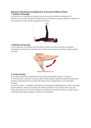 El Signo de Musset es un signo clínico - El Signo de Musset es un signo ...