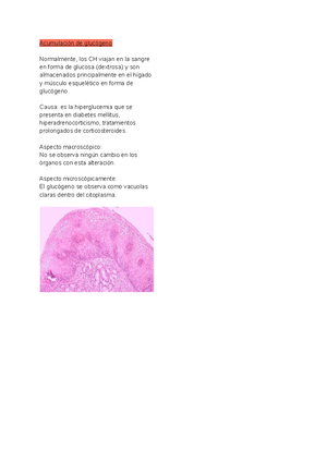 Muerte somatica - La muerte es el cese irreversible de funciones ...