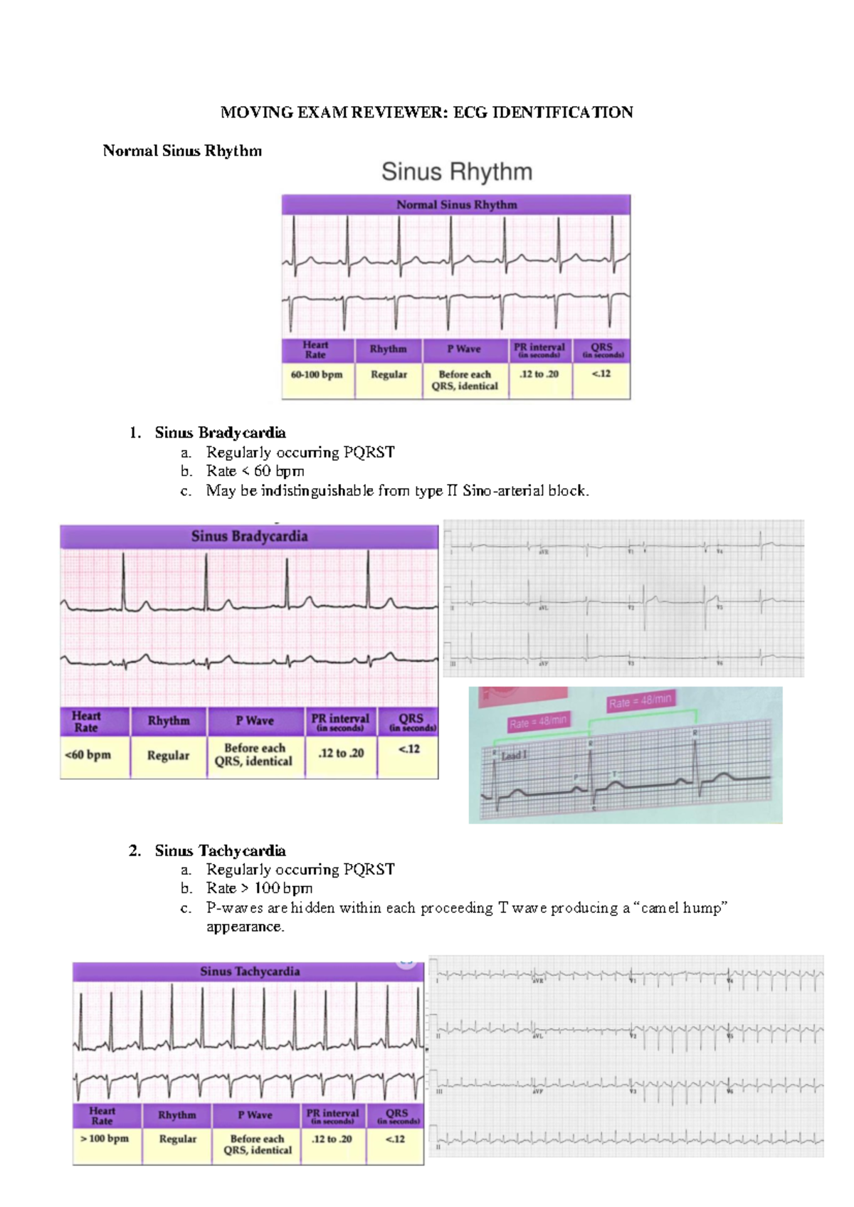 ECG Indentification Moving EXAM Reviewer - MOVING EXAM REVIEWER: ECG ...
