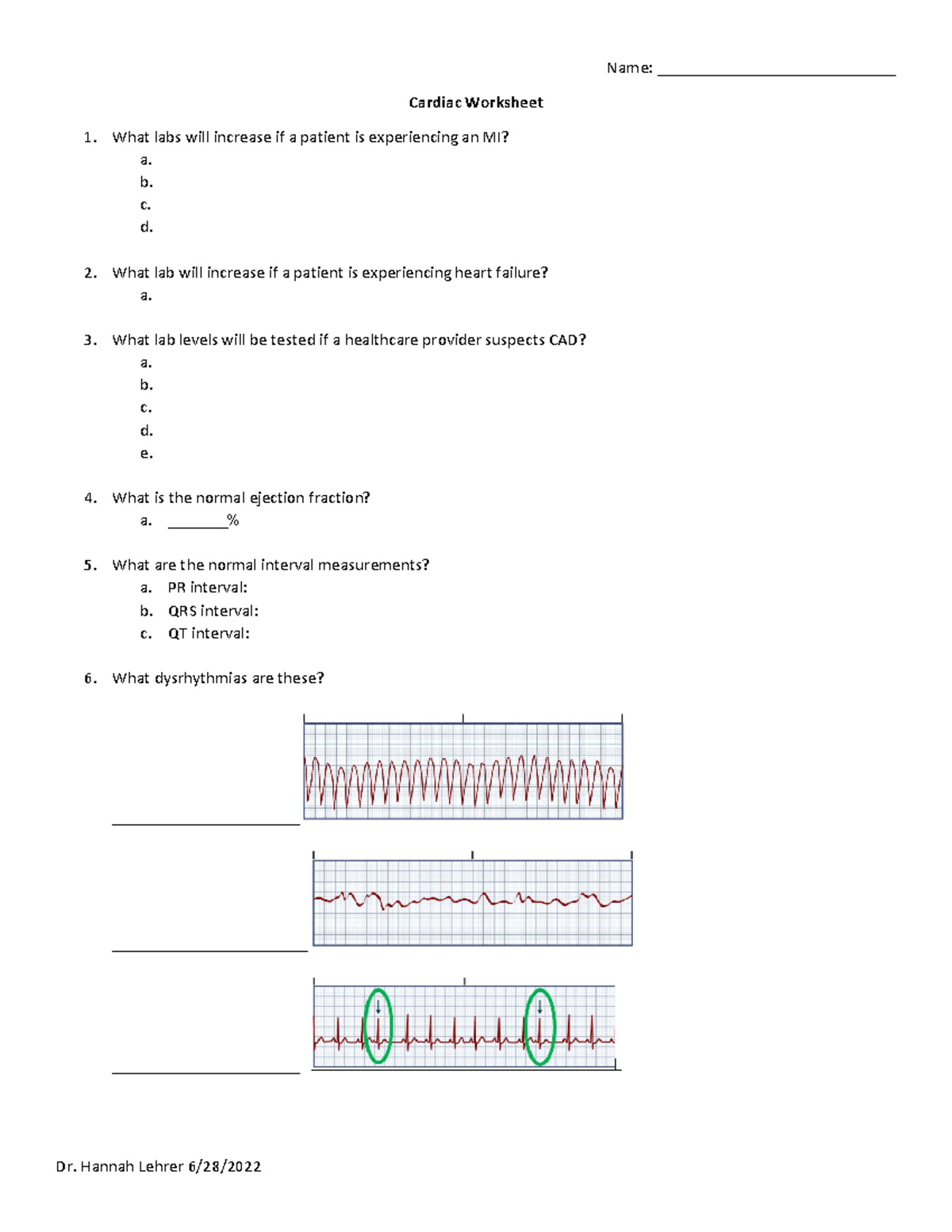 NR324 Cardiac Worksheet - Dr. Hannah Lehrer 6/28/ Name ...