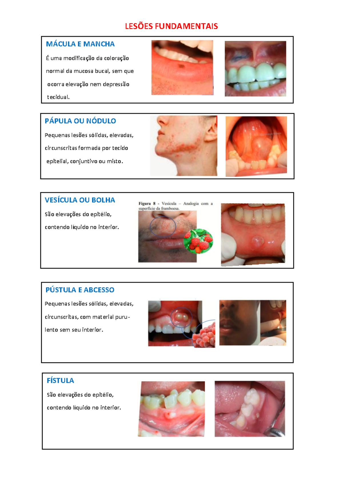 Lesões Fundamentais - LESÕES FUNDAMENTAIS MÁCULA E MANCHA É uma ...