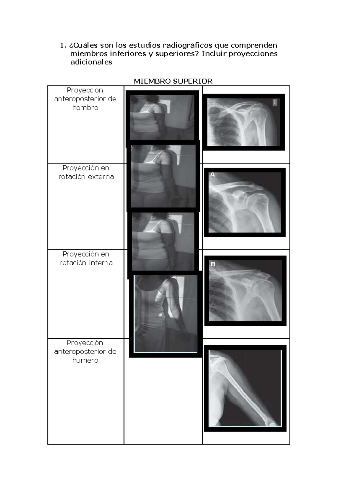 Aporte Imagenologia 2 YULI - 1. ¿Cuáles son los estudios radiográficos ...