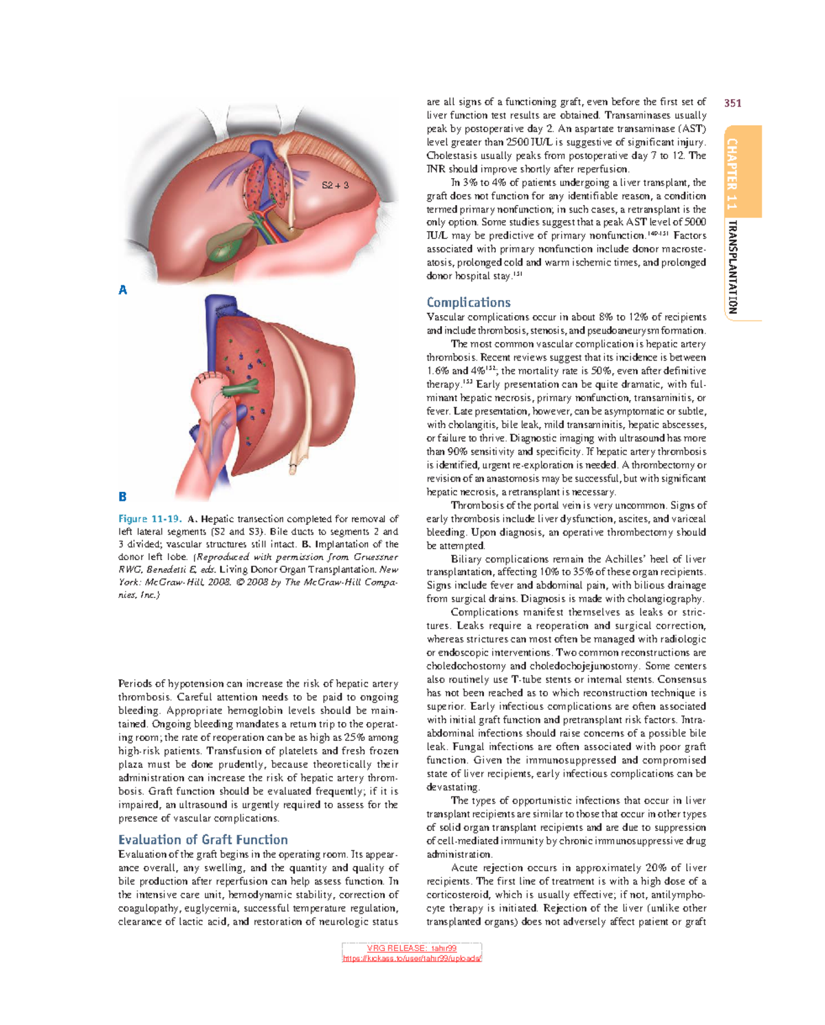 Schwartz's Principles of Surgery-40 - 351 TRANSPLANTATION CHAPTER 11 ...