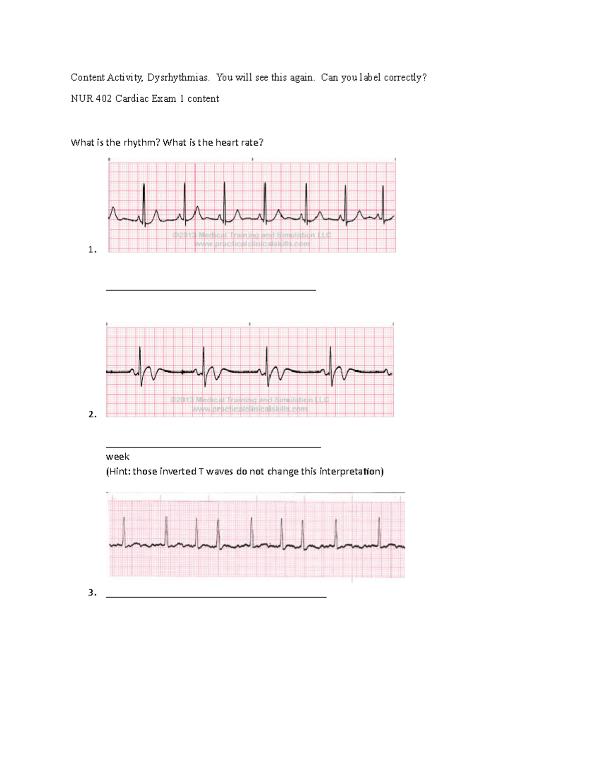 Aacn Identifying Dysrhythmias Exam Answers Chapter 07 Dysrhy