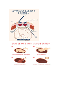 Ascending Pathways - ASCENDING TRACTS– MATHEUS M. On entering the ...