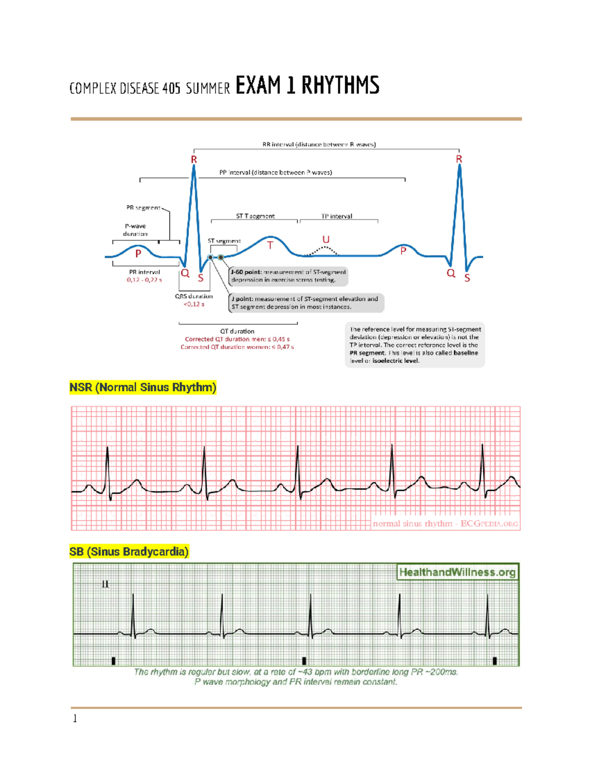 Rhythms on Exam 1 - none. - COMPLEX DISEASE 405 SUMMER EXAM 1 RHYTHMS ...