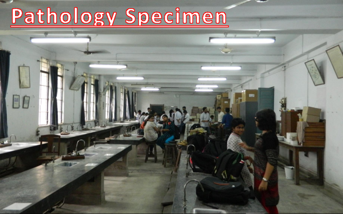 Patho specimen - Path practicals - Granular Contracted Kidney Small in size, Granulated ...