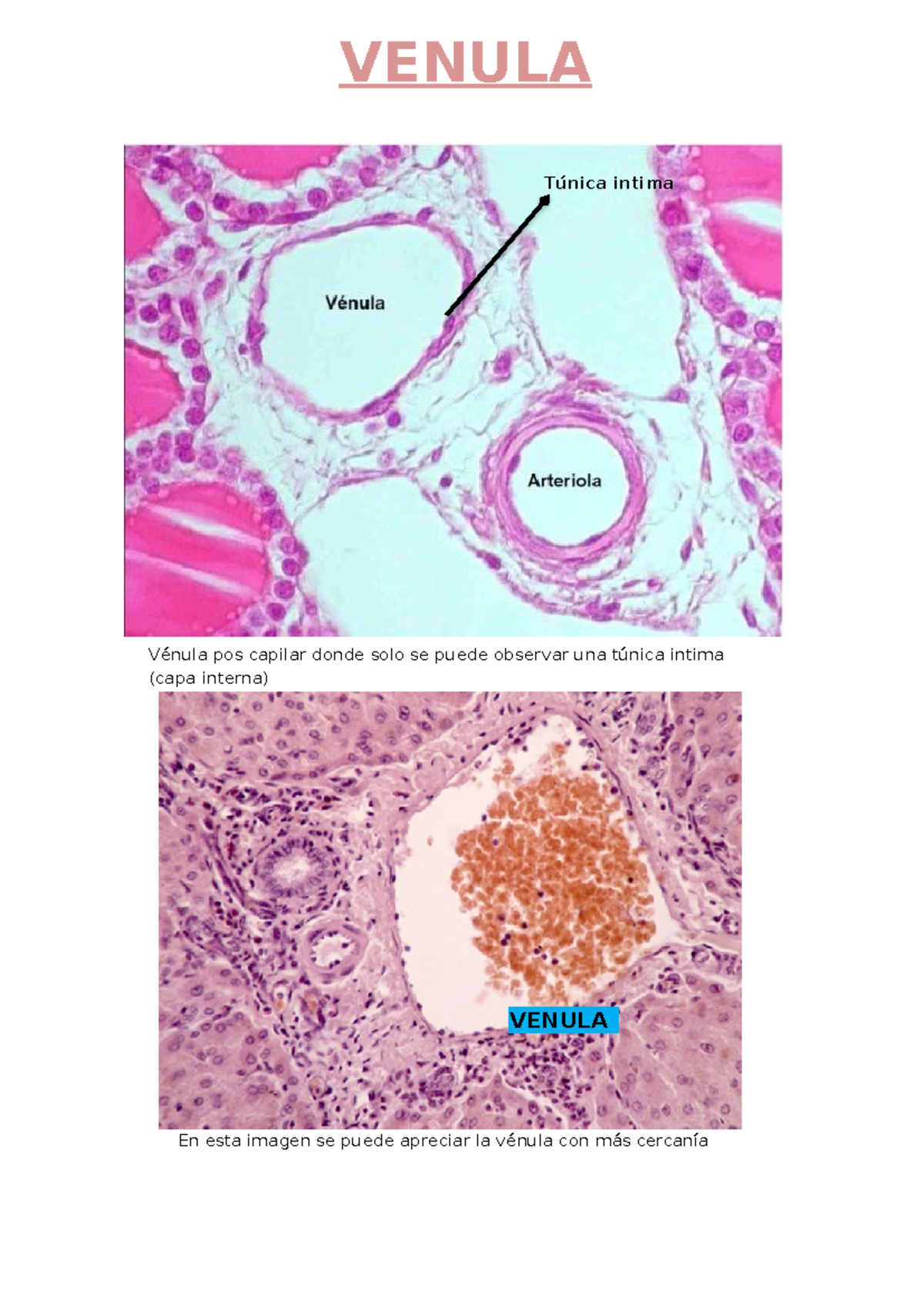 Venulas (GUPO 30) - apuntes - Histología y Embriología - VENULA Vénula ...
