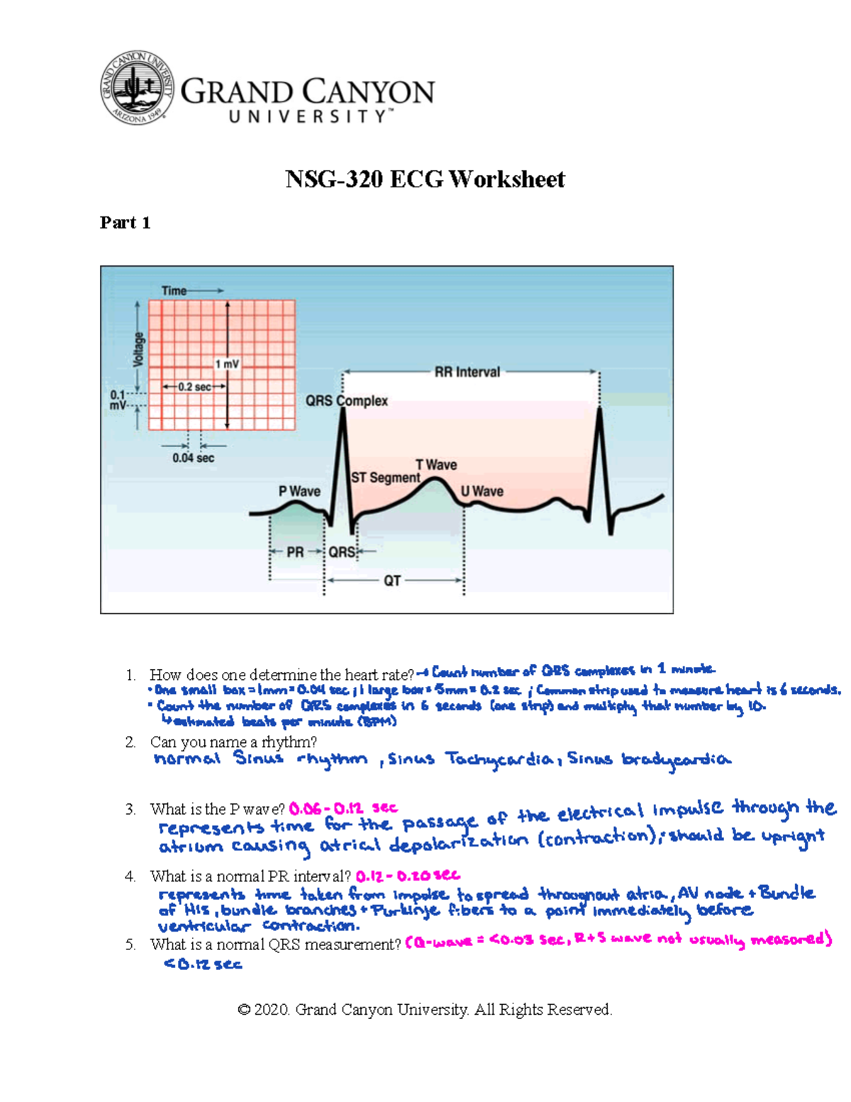 NSG-320 ECG Worksheet - Analysis of 10 ECG strips for NSG 320 at Grand ... NSG-320 ECG Worksheet - Analysis of 10 ECG strips for NSG 320 at Grand ...