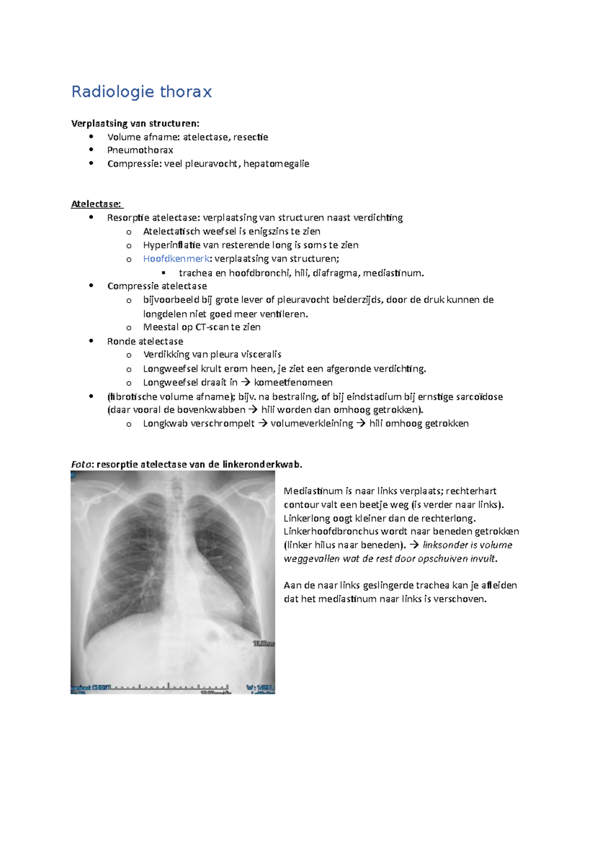 Thema 6 Dyspneu - Radiologie thorax Verplaatsing van structuren: Volume ...