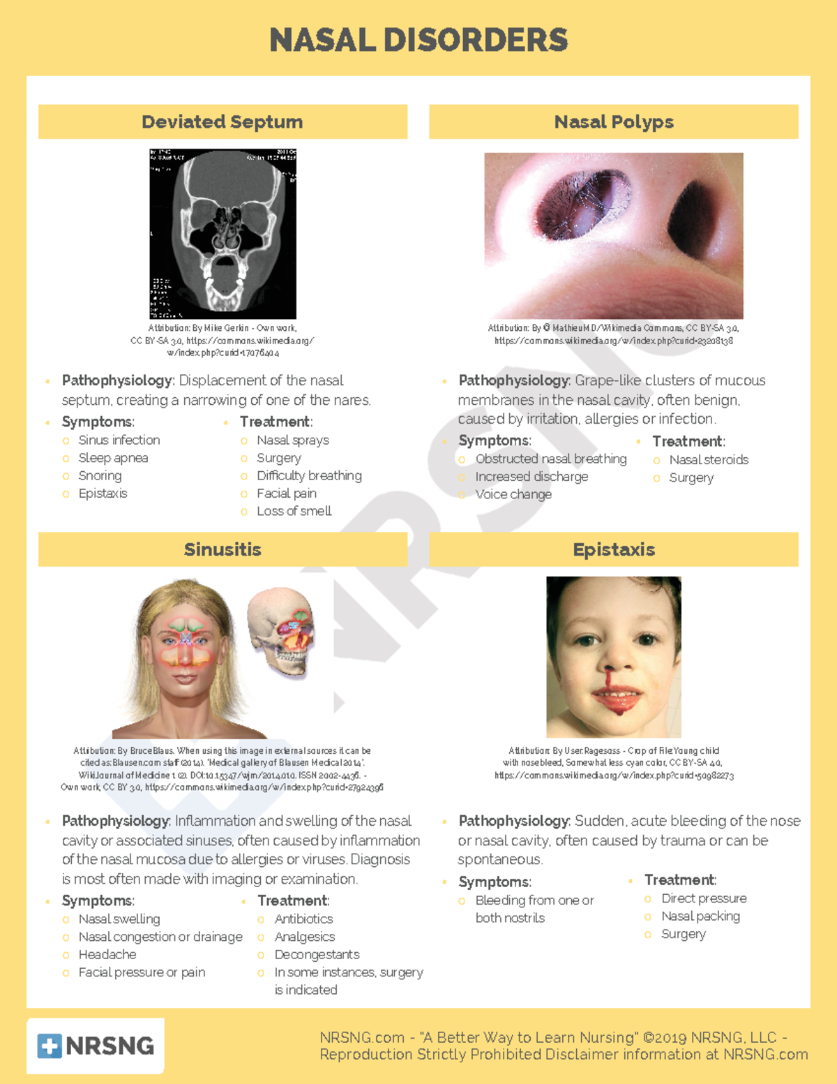 Cs-eent-006-nasal disorders - NASAL DISORDERS NRSNG - “A Better Way to ...