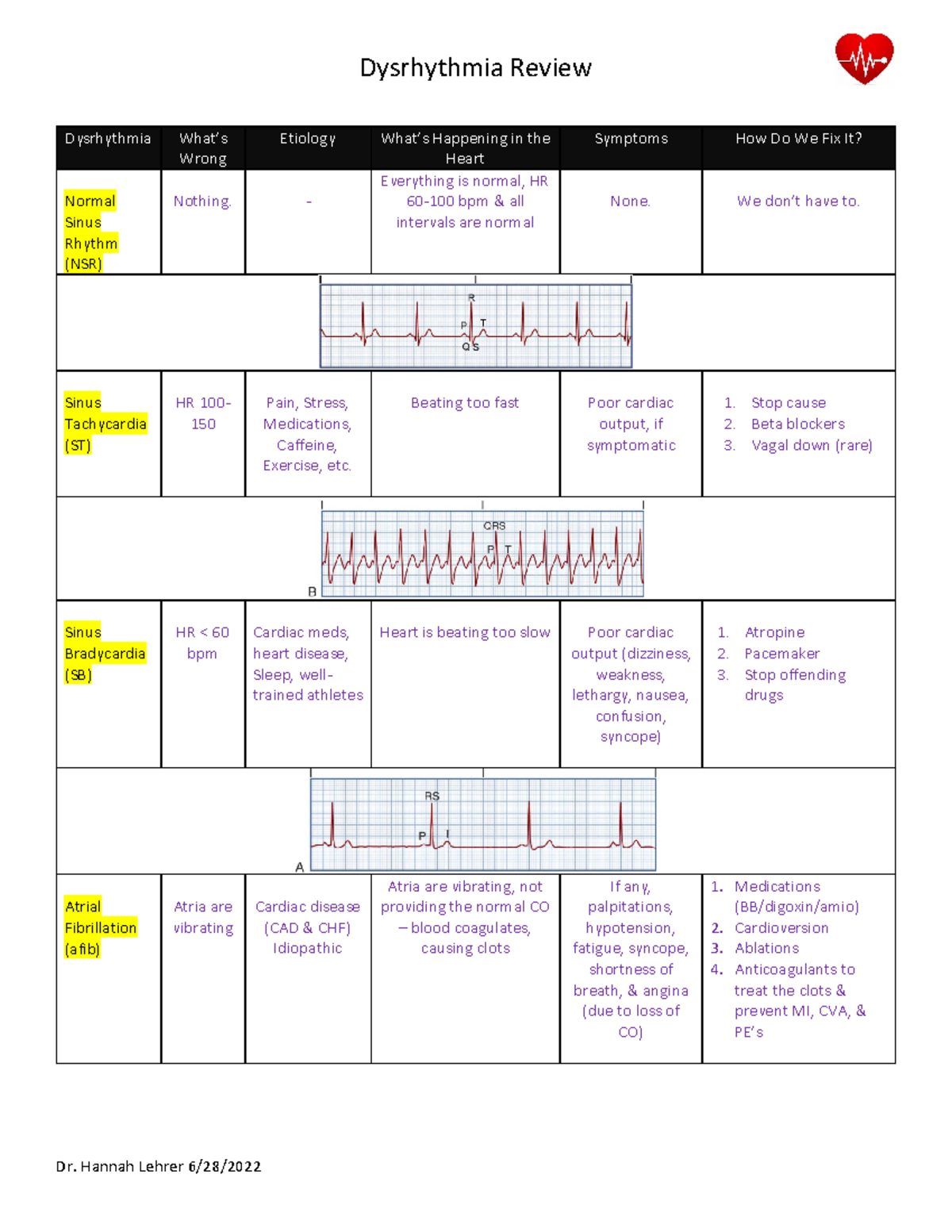 Dysrhythmia Review Sheet - Dysrhythmia What’s Wrong Etiology What’s ...