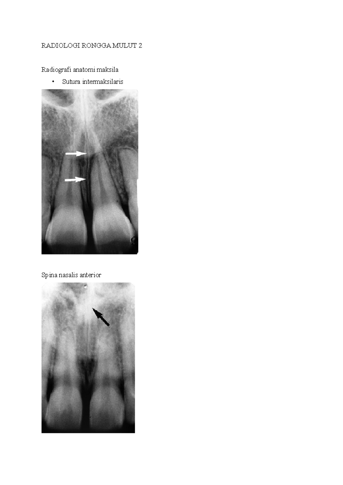 Radiologi Rongga Mulut 2 - RADIOLOGI RONGGA MULUT 2 Radiografi anatomi ...