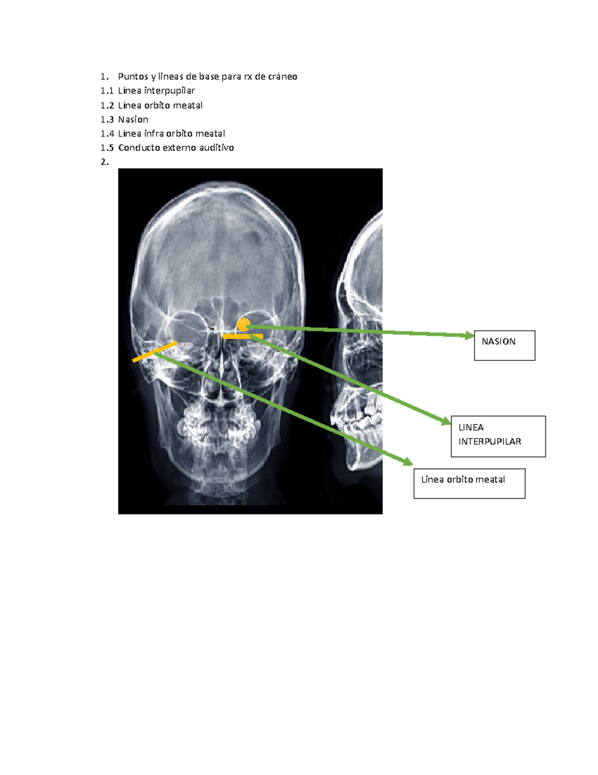 Actividades del libro - Puntos y lineas de base para rx de cráneo 1 ...