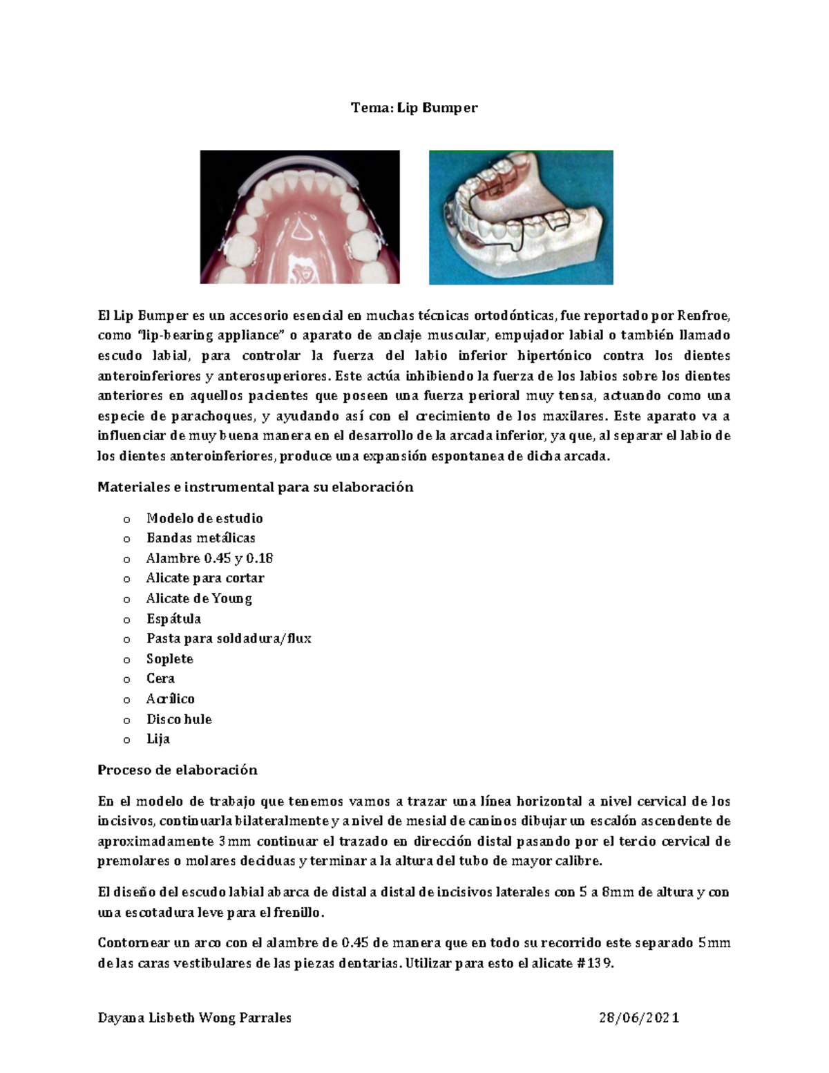 LIP Bumper - Tema: Lip Bumper El Lip Bumper es un accesorio esencial en ...