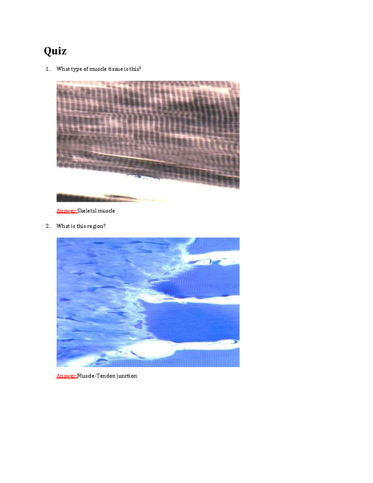 Quiz Muscles mammalian histology - Quiz What type of muscle tissue is ...