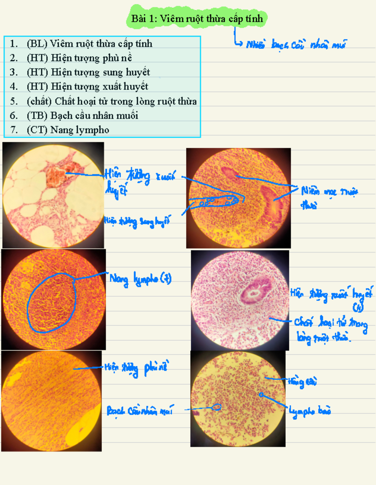 Thực hành Giải phẫu bệnh (1) 2 - Bài 1: Viêm ruột thừa cấp tính (BL ...