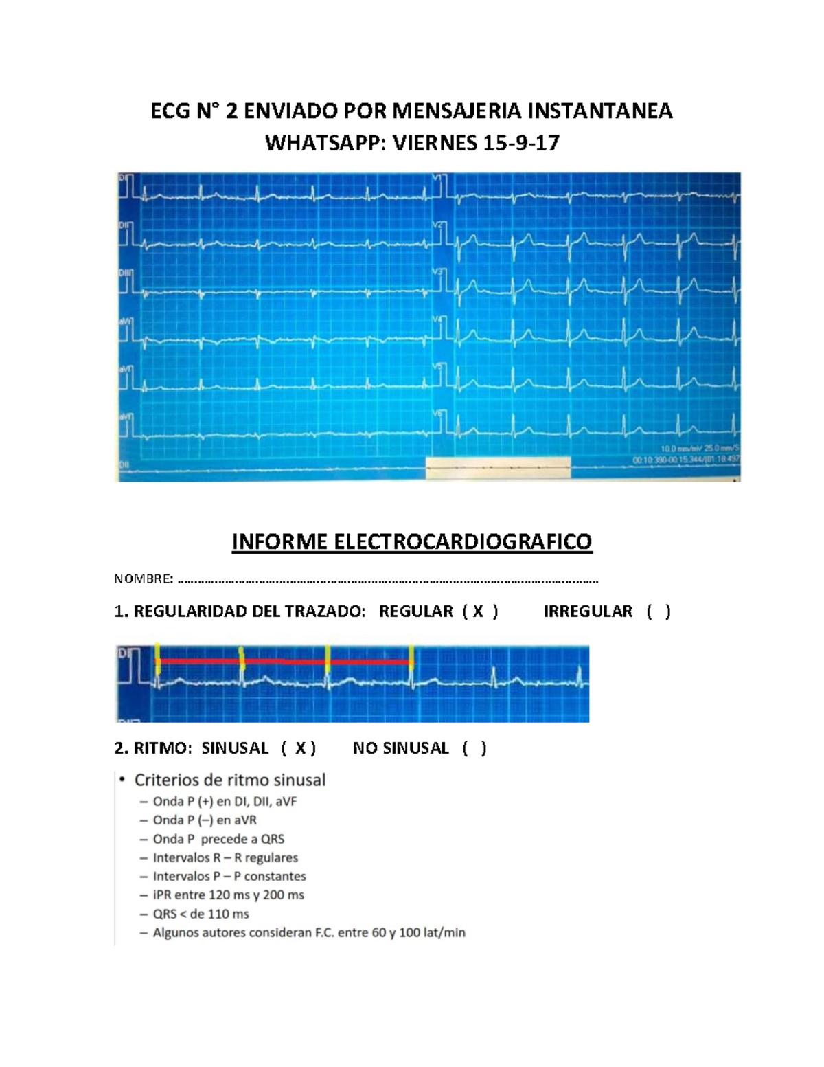 Informe DE ECG Explicado - ECG N° 2 ENVIADO POR MENSAJERIA INSTANTANEA ...