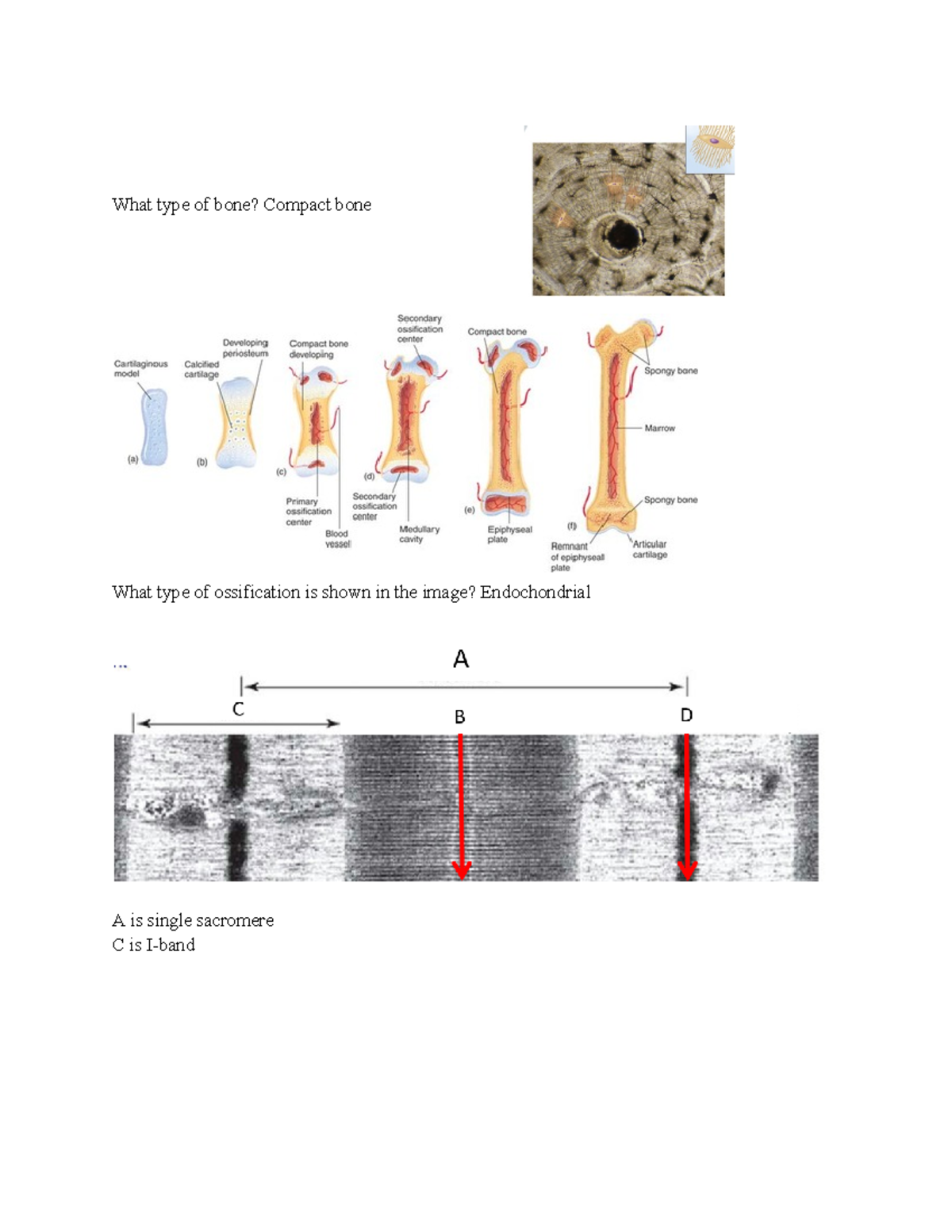 KINS 1223 Unit 3 Study Guide - What type of bone? Compact bone What ...