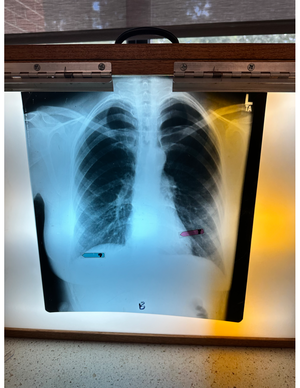 Egan’s ch. 3 workbook - Kailey Ward - RESP 3111 - Studocu