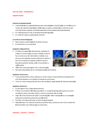 Prótese Fixa (resumão) - Classificação das próteses parciais fixas ...