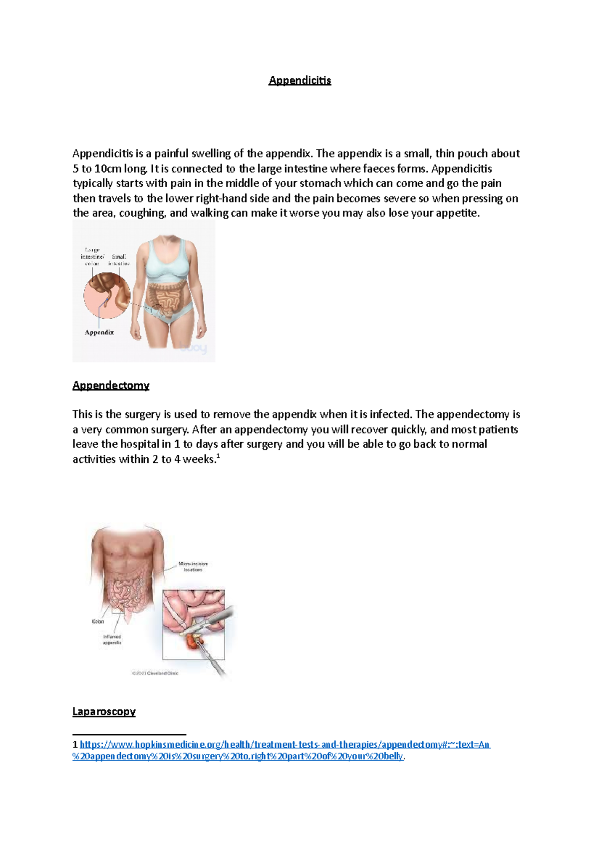 Appendicitis - Lecture notes 1-8 - Appendicitis Appendicitis is a ...