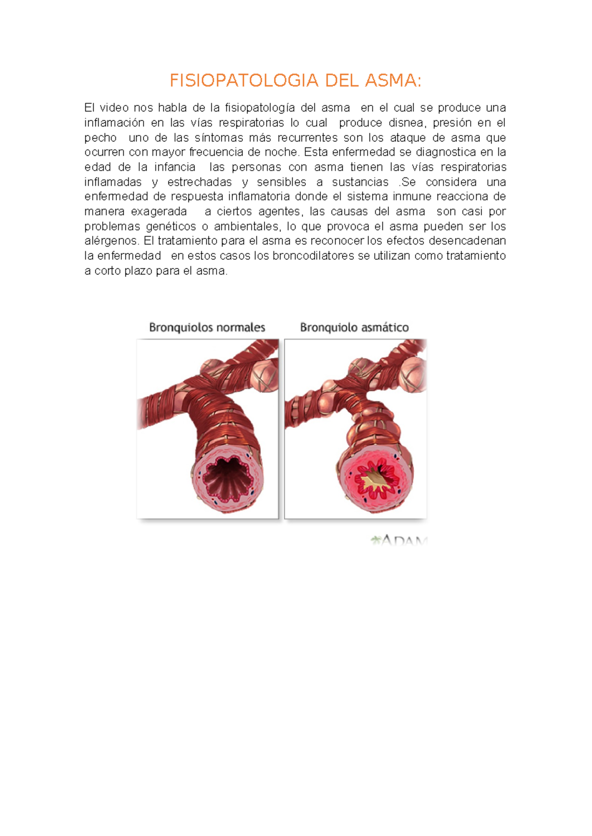 Fisiopatologia DEL ASMA - FISIOPATOLOGIA DEL ASMA: El video nos habla ...